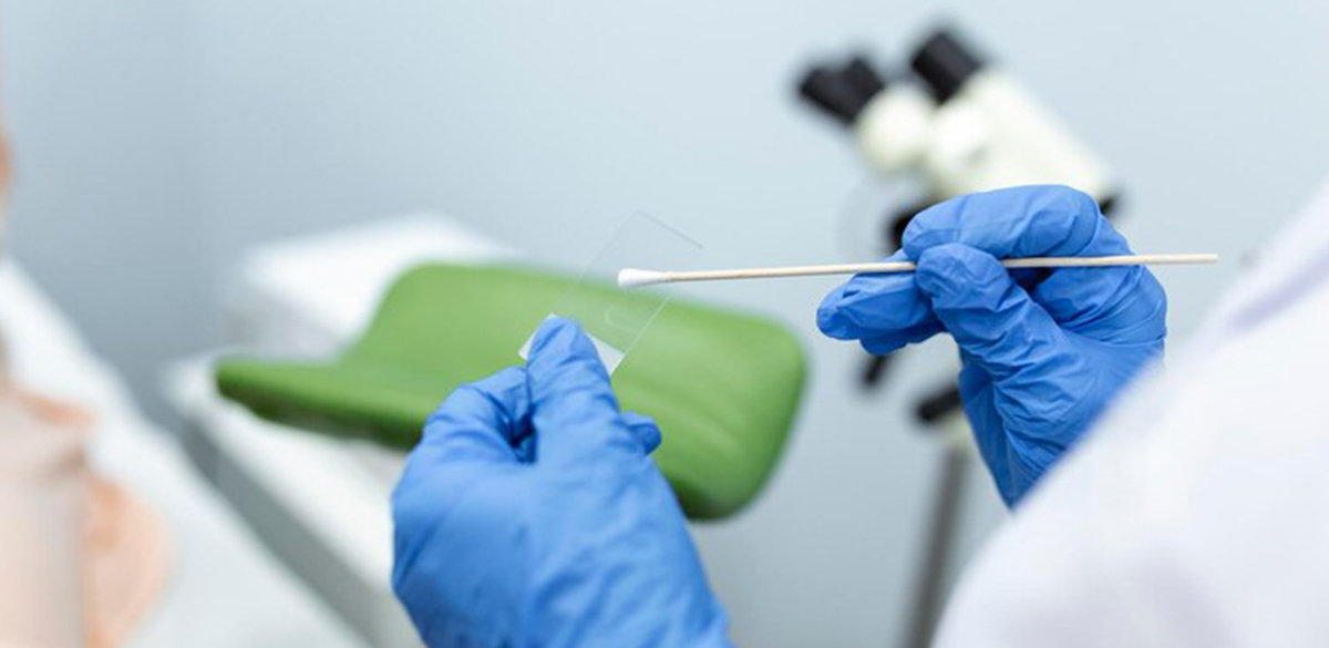 Gynaecologist Oncologist’s Guide to Pap Smears