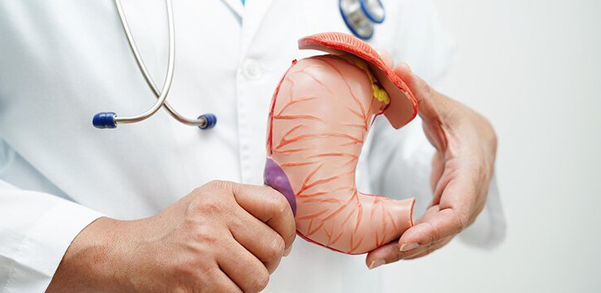 Gastric Polyps: Types, Causes, Symptoms & Treatment Explained