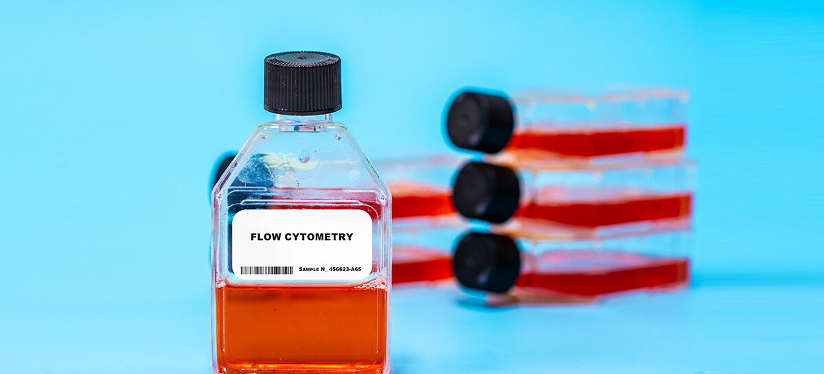 How is Fluorescence Flow Cytometry Revolutionising Urinalysis?
