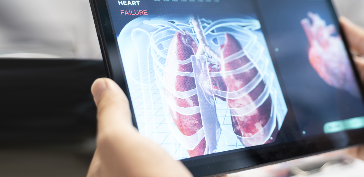 What Is VATS (Video-Assisted Thoracoscopic Surgery)? Benefits ...