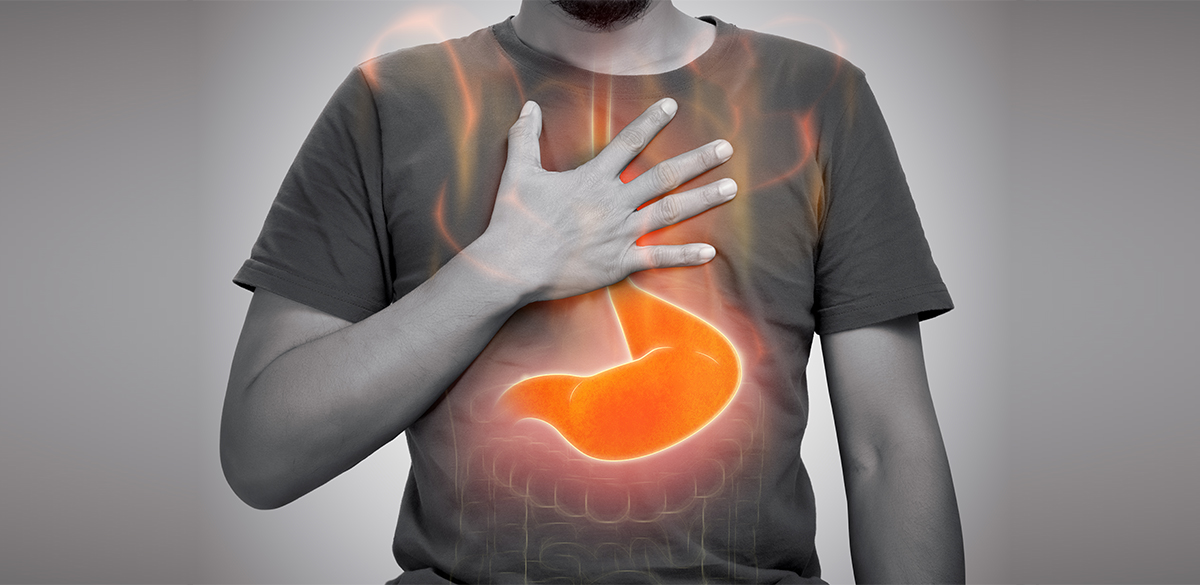How to Control Acid Reflux Naturally | GERD Diet & Lifestyle Tips