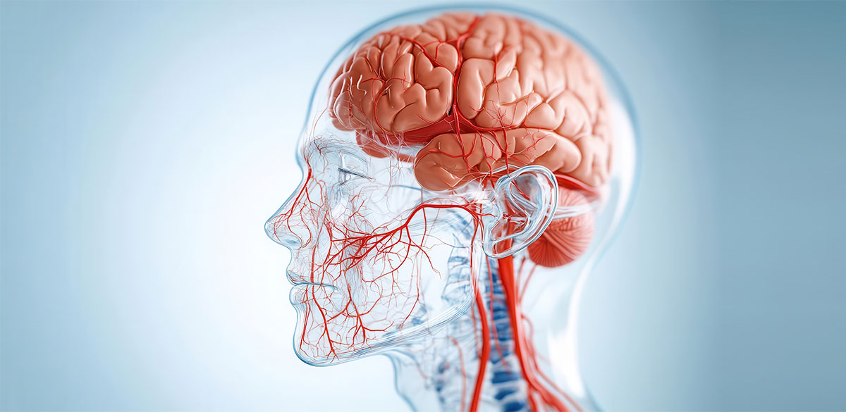 What Is Moya Moya Disease and How Is It Treated with Brain Bypass Surgery?