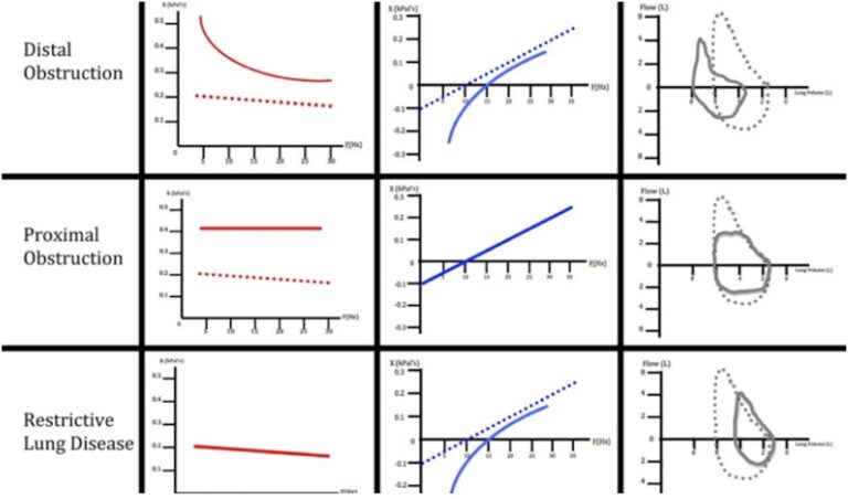 Role of FOT in Pulmonary Diseases in Clinical Experience