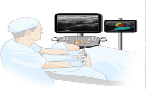 Artificial Intelligence in Anaesthesiology