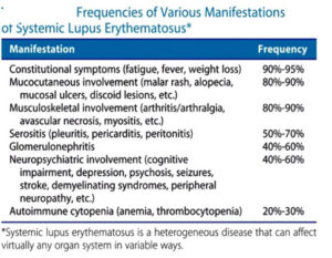 Multisystemic Flare of Systemic Lupus Erythematosus Presenting as Lupus ...