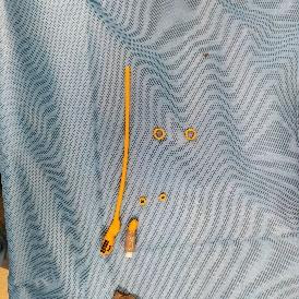 Dynamic external fixator for unstable intra articular fractures of ...