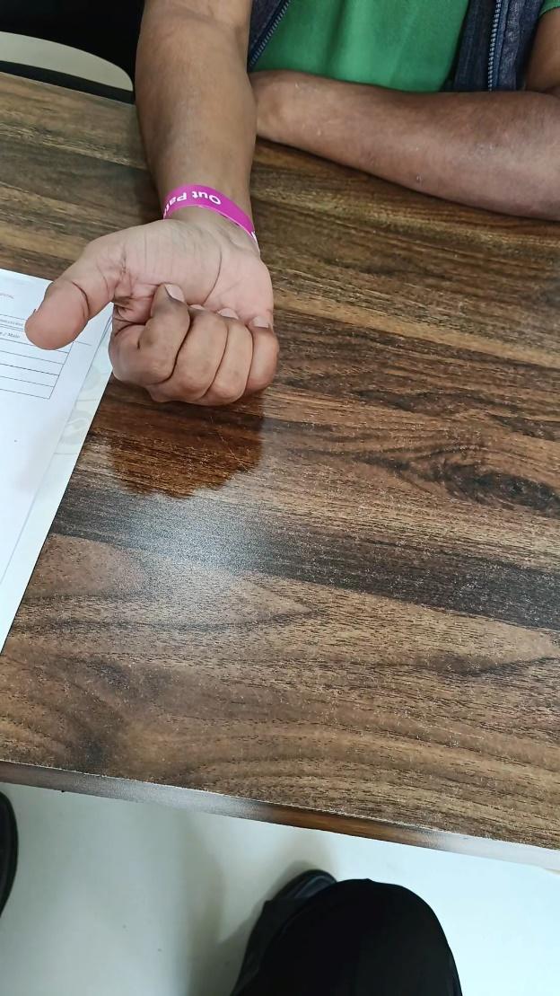 Dynamic external fixator for unstable intra articular fractures of ...