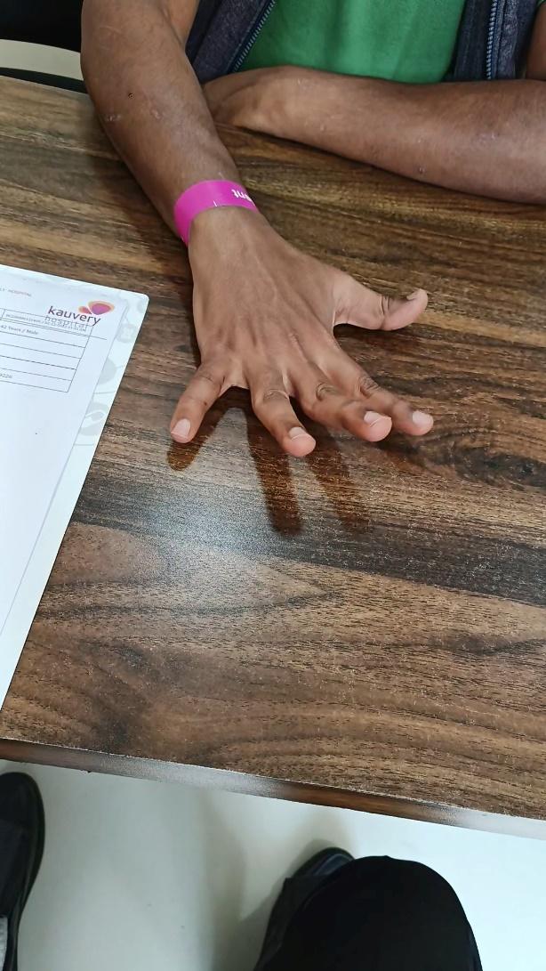 Dynamic external fixator for unstable intra articular fractures of ...