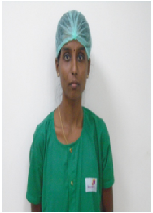 Left mediastinal tumor excision - Kauvery Hospital