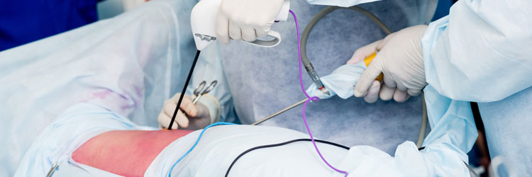 Best Surgical Oncologist in Chennai, Trichy, and Salem | Surgery for ...