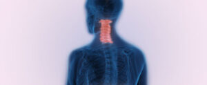 Degenerative Cervical Spine Disorders - Symptoms and Treatment