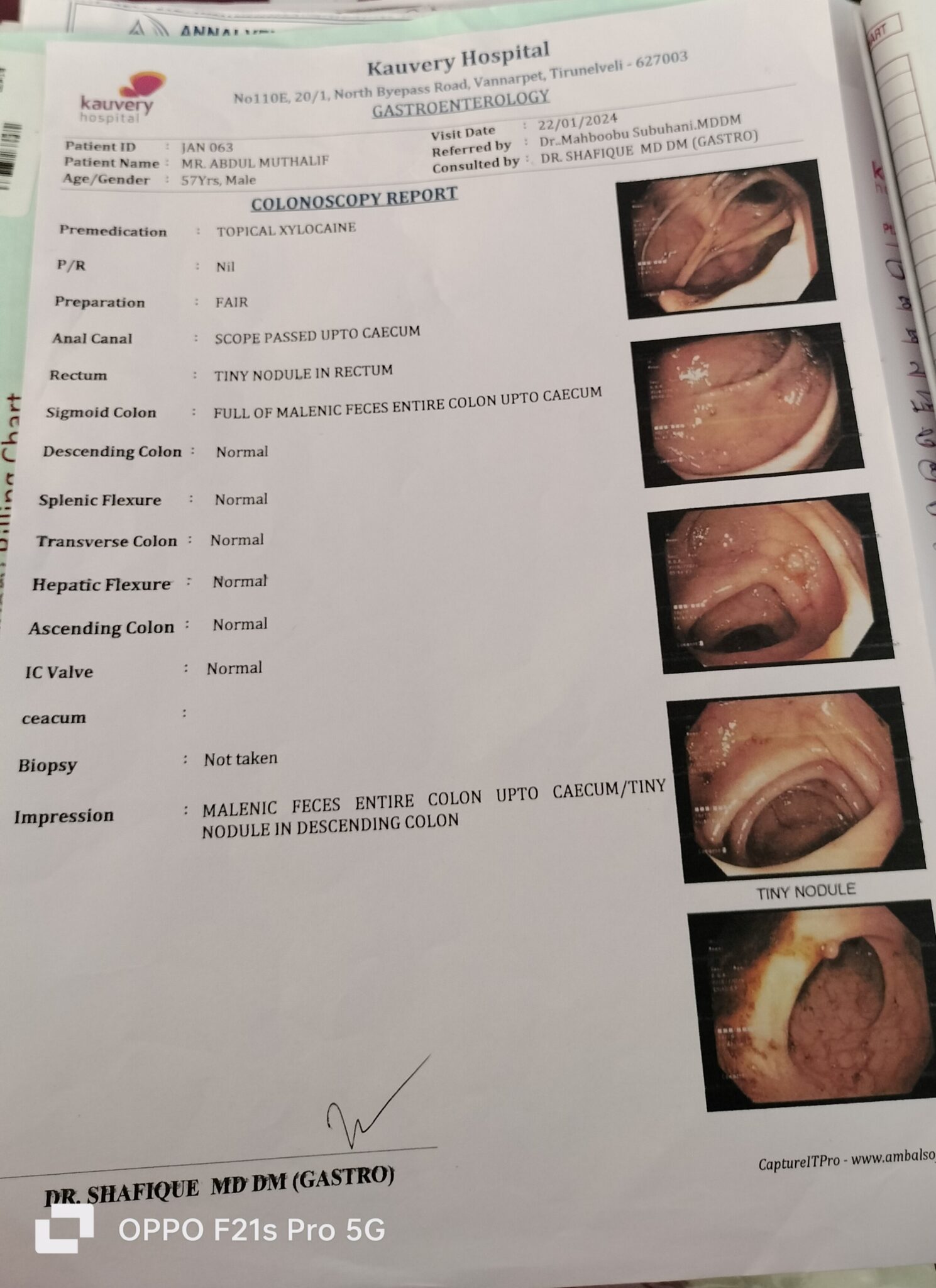Capsule Endoscopy Case Study: Diagnosing Small Bowel Ectasia & Anemia ...