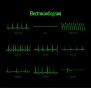 Electrocution: A comprehensive review - Kauvery Hospital
