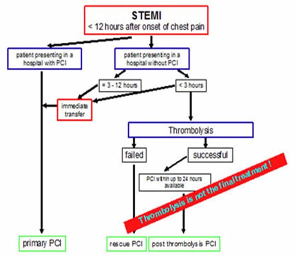Early Rescue PCI After Failed Thrombolysis in STEMI – Case Study | Kauvery Hospital