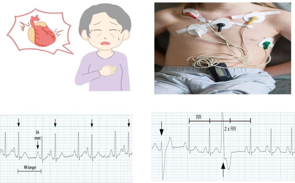 Pediatric Arrhythmias Diagnosis & Management in Children | Kauvery Hospital