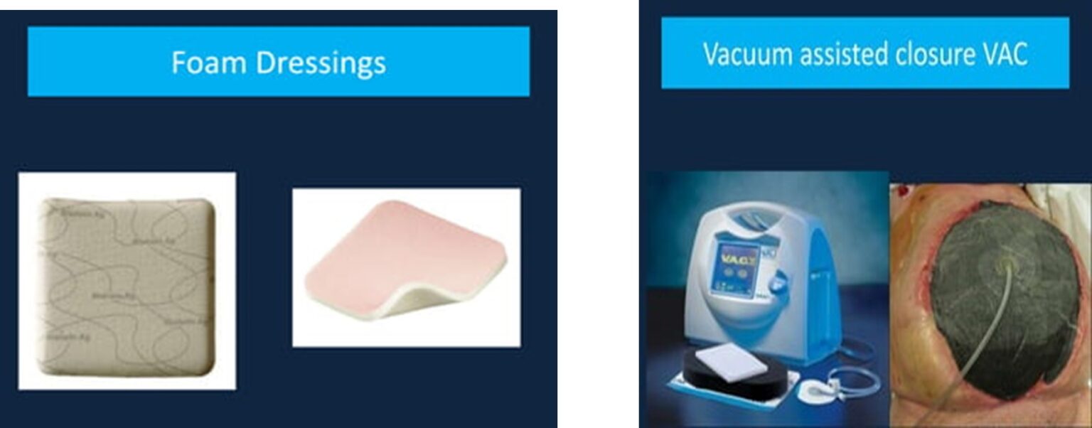 Wound Care Guide: Assessment, Treatments & Dressings | Kauvery Hospital