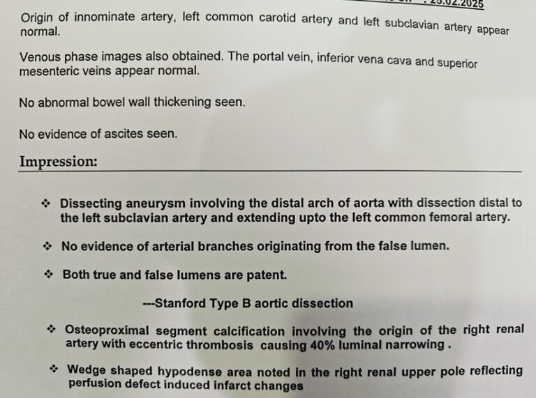 TEVAR for Type B Aortic Dissection in Elderly | Kauvery Hospital Case ...