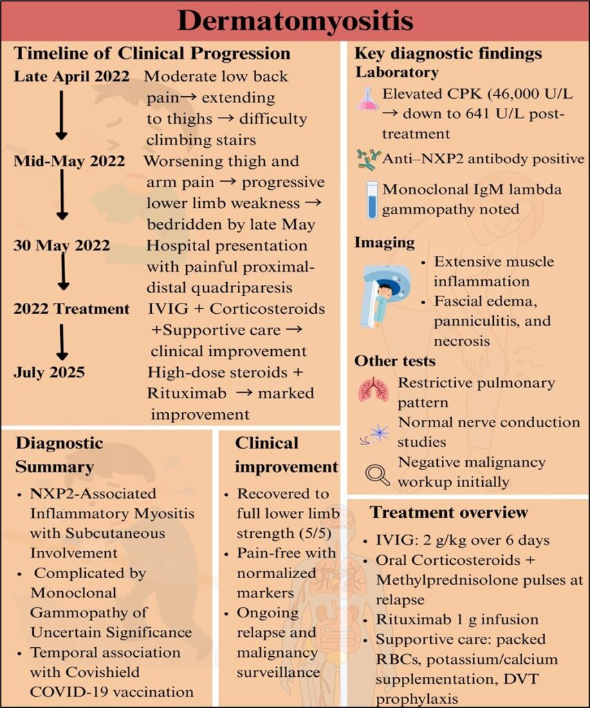 Adult-Onset Anti-NXP2 Dermatomyositis and MGUS triggered by COVID-19 ...