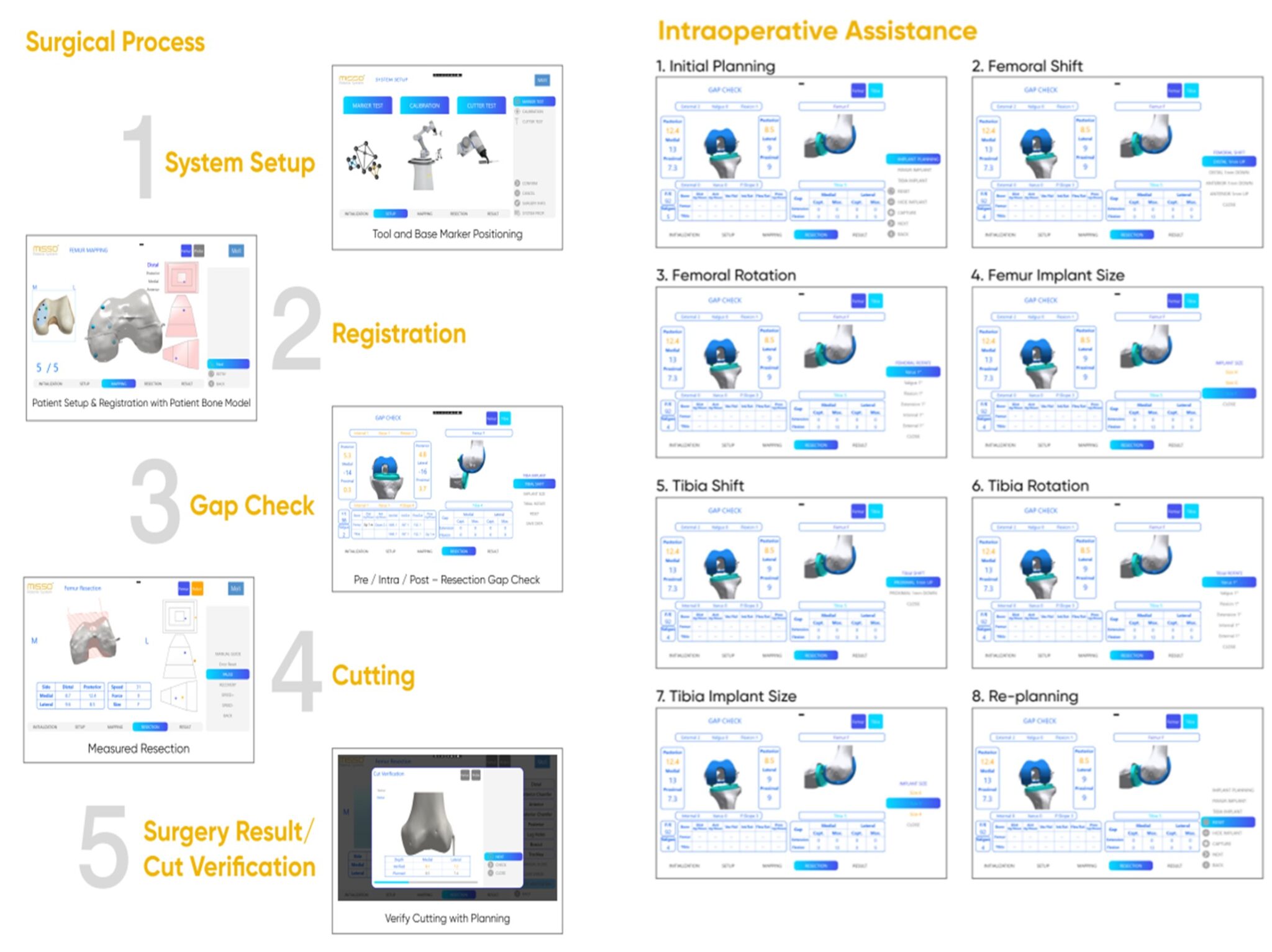 Pioneering the future: The first step in robotic surgery - Kauvery Hospital