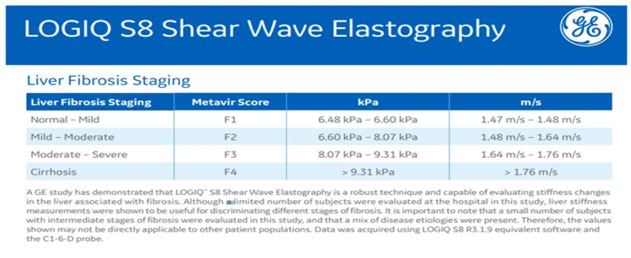 What Is Liver Elastography? – Types, Benefits, Limitations